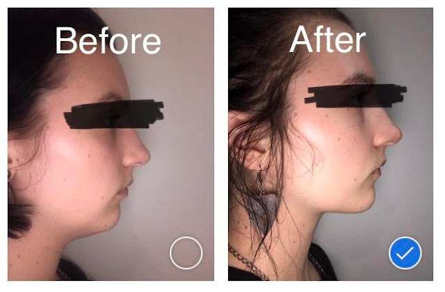 Những điều bạn cần biết về mewing ~ The beausty