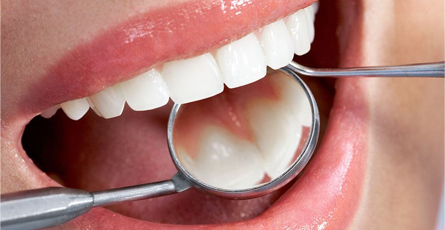 Periodontia - Odontologia Saliba | Blog