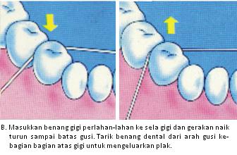 Panduan Cara Memakai Menggunakan Benang Gigi dengan Benar | Floem