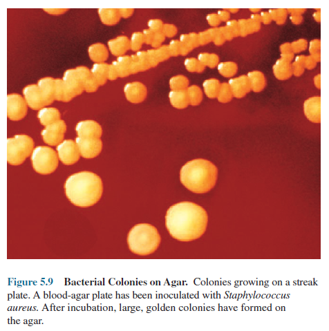 Microbiology Notes: Microbial Nutrition