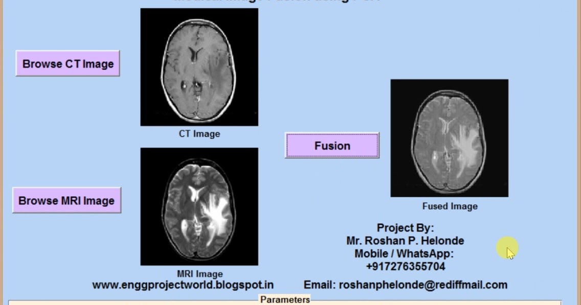 Matlab Code for Image Fusion using PCA Principal Component Analysis ...