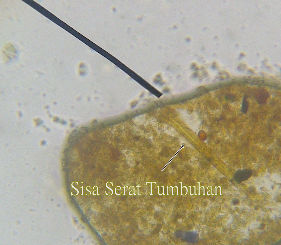 Rizqi Murtafi'ah: Pemeriksaan Feses Lengkap