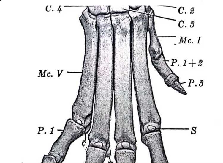 Bones of Metacarpus | Gross Anatomy | Anjani Mishra