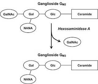 Tay-Sachs Disease Case File