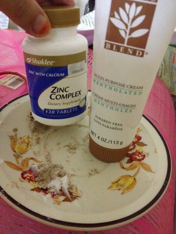 Ubat Antibiotik Untuk Chicken Pox - Jurupulih l