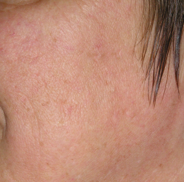 The Face Experiment: Side of Cheek