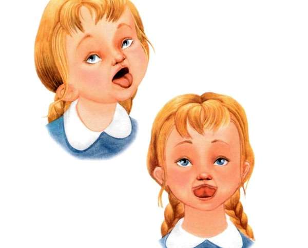 Территория правильной речи Артикуляционная гимнастика