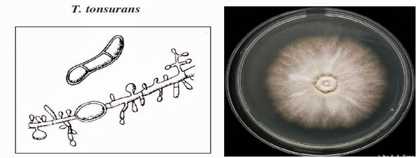 Crescendo em Cultura: Dermatofitoses
