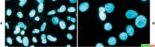 [Microbiology] Atlas of Mycoplasma and Ureaplasma | Free Medical Atlas