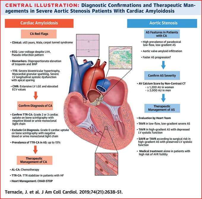 ZONA DE SALUD DE OFRA: JACC. Estenosis aórtica vs amiloidosis cardiaca.