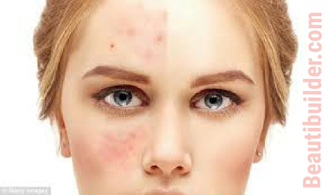 what is sensitive skin, its features, causes,treatments