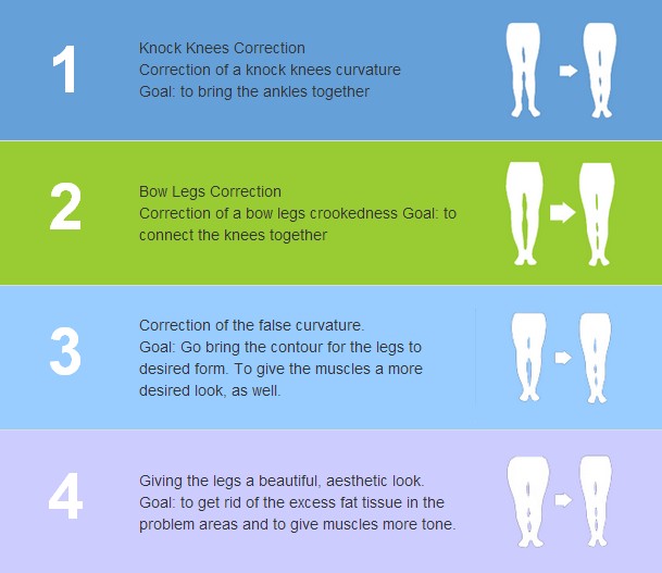 Bow legged correction ----making legs look more perfect