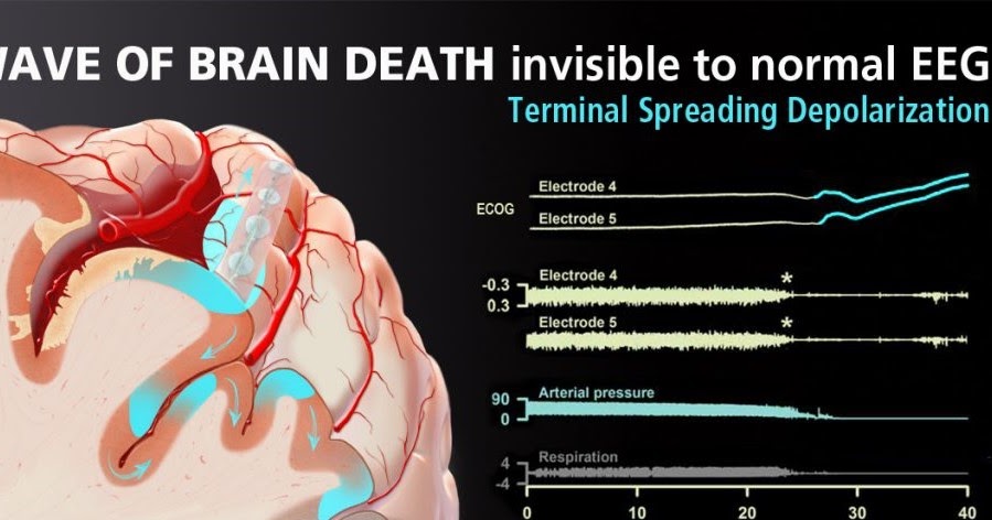 The Health Hub: Brain death - Overview