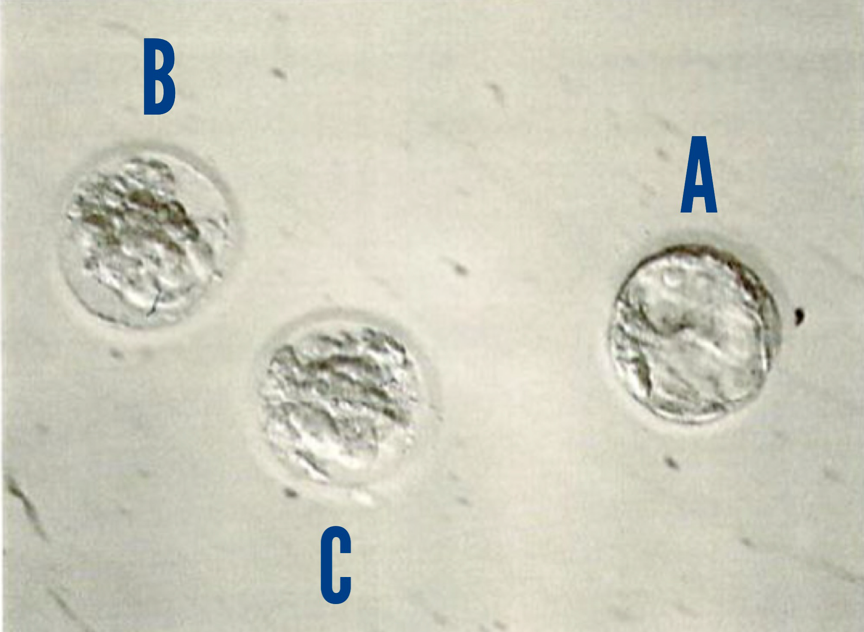 Baby On Mind: Transfer Day 1/21/14 (Delayed Post)