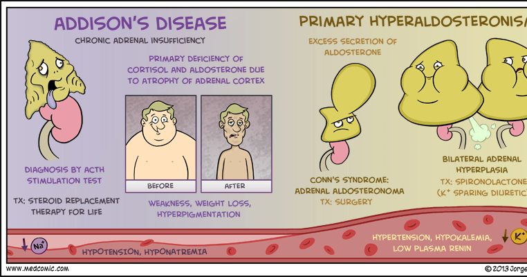 Addison Disease