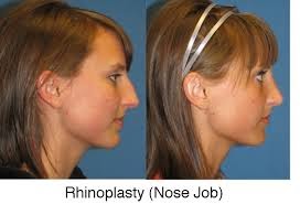 Medical Treatment Pictures-for Better Understanding: Turbinate ...