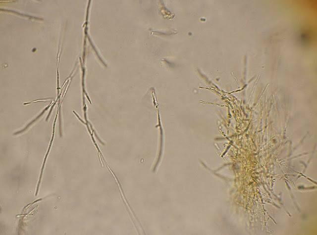 ATLAS MICOLOGIA: TRICHOPHYTON SOUDANENSE