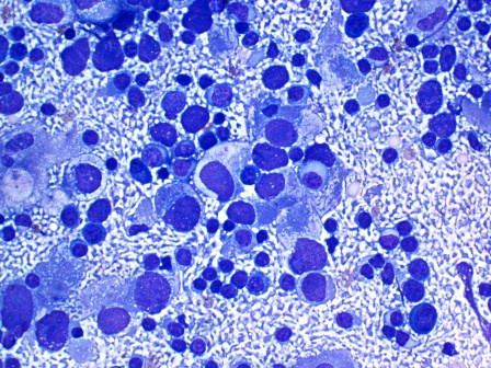 Técnicas de laboratorio en Anatomía Patológica: Diff-Quick