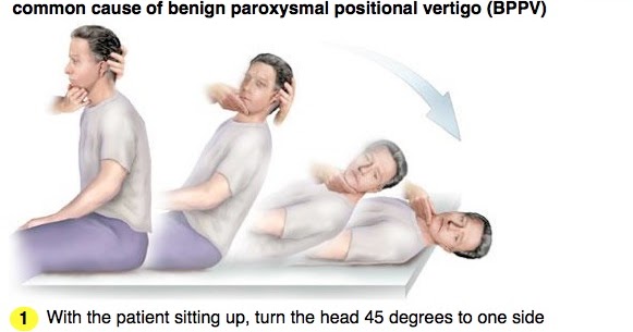 ZONA DE SALUD DE OFRA: Intramed. Vértigo agudo.