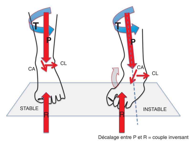 La biomécanique de la cheville.