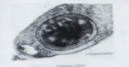 Pembentukan Spora Bakteri Dan Pertumbuhan Bakteri (Berbagai Sifat ...