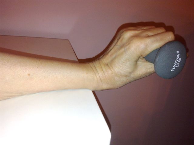 Handrehabilitationcase with Dupuytren's contracture.: A trauma in the ...