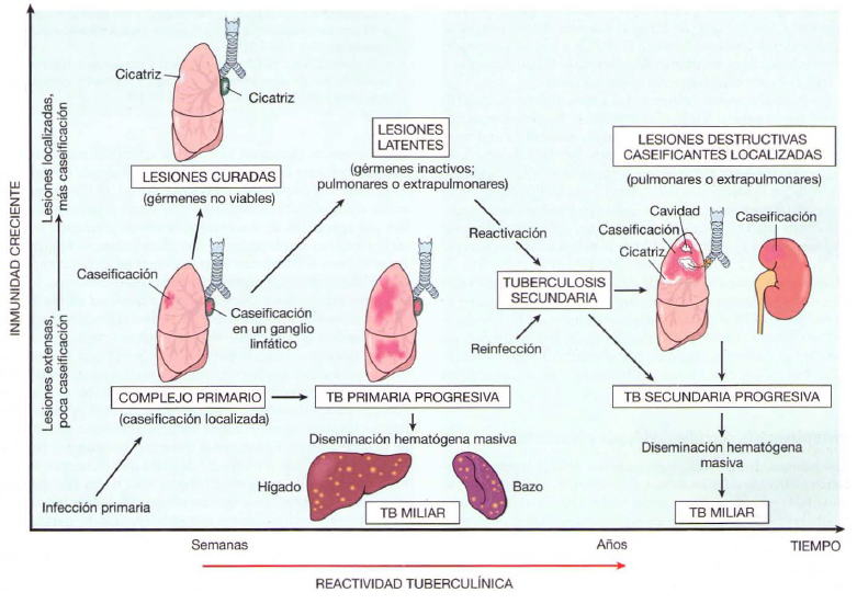 Guadalupe Masutti PATOB 2014: ETIOLOGIA Y PATOLOGIA DE LA TUBERCULOSIS