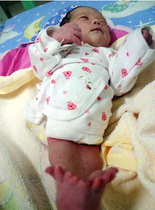 Updated news around the world: twins share single heart -1