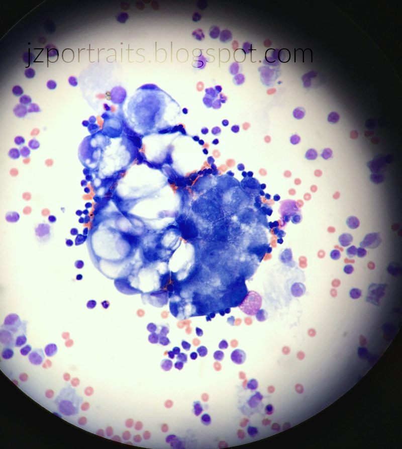 JZportraits: Malignant Cells | 🔎🔬Madscientist