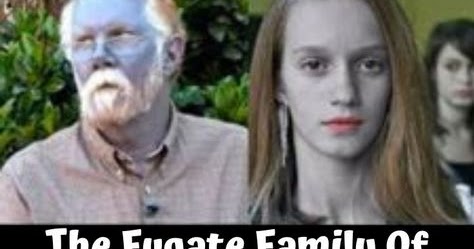The Fugate Family Of Kentucky Has Had Blue Skin For Centuries — Here’s Why