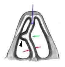 Can a Deviated Septum Cause Facial Pain? | Fauquier ENT Blog