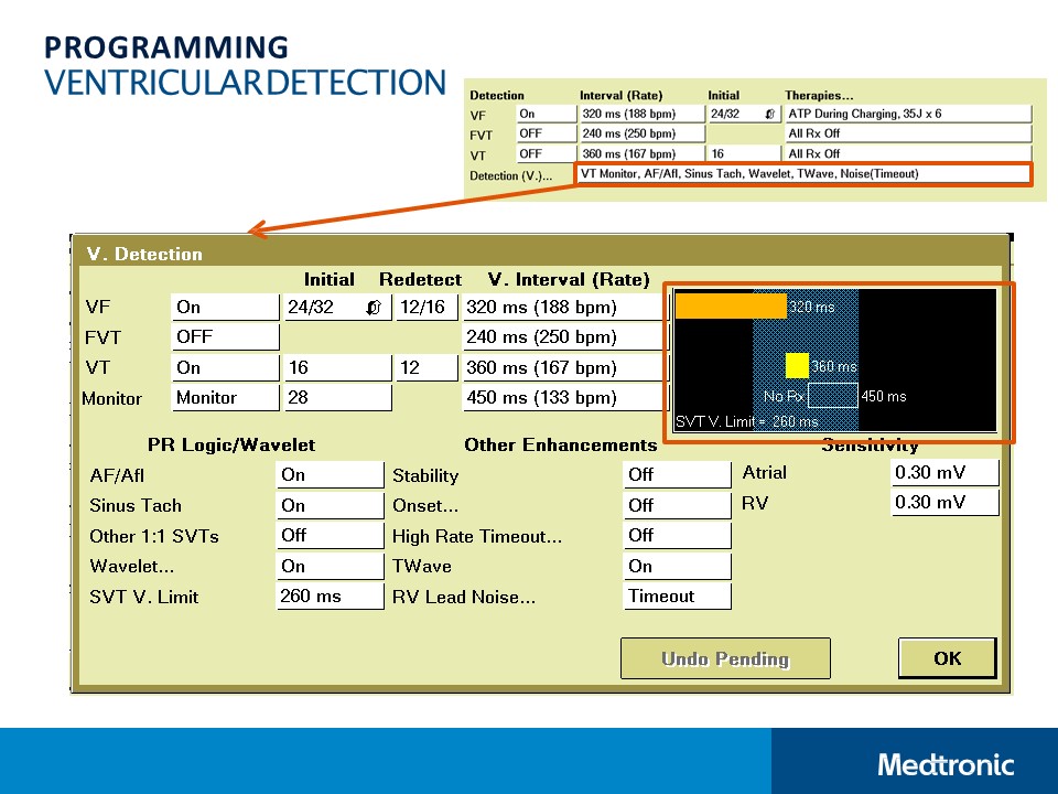 CVT Mohd Farid: Concept Of ICD Technology-Sensing & Detection-Medtronic ...