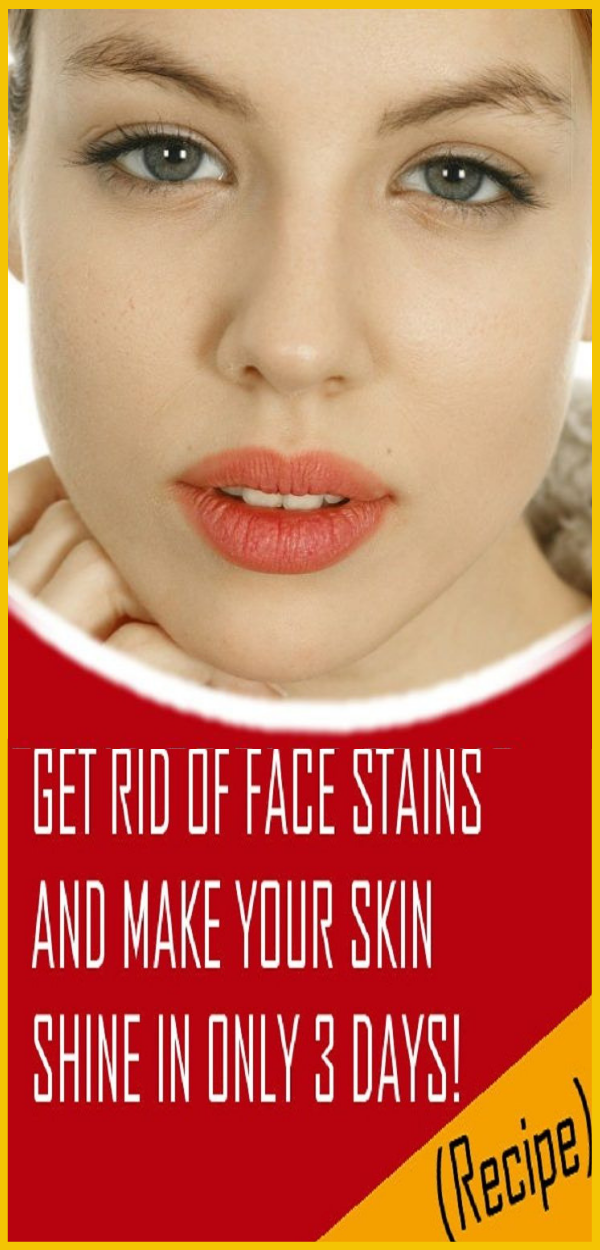Get Rid Of Face Stains And Make Your Skin Shine In Only 3 Days! (Recipe ...