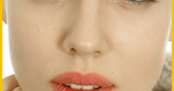 Get Rid Of Face Stains And Make Your Skin Shine In Only 3 Days! (Recipe ...