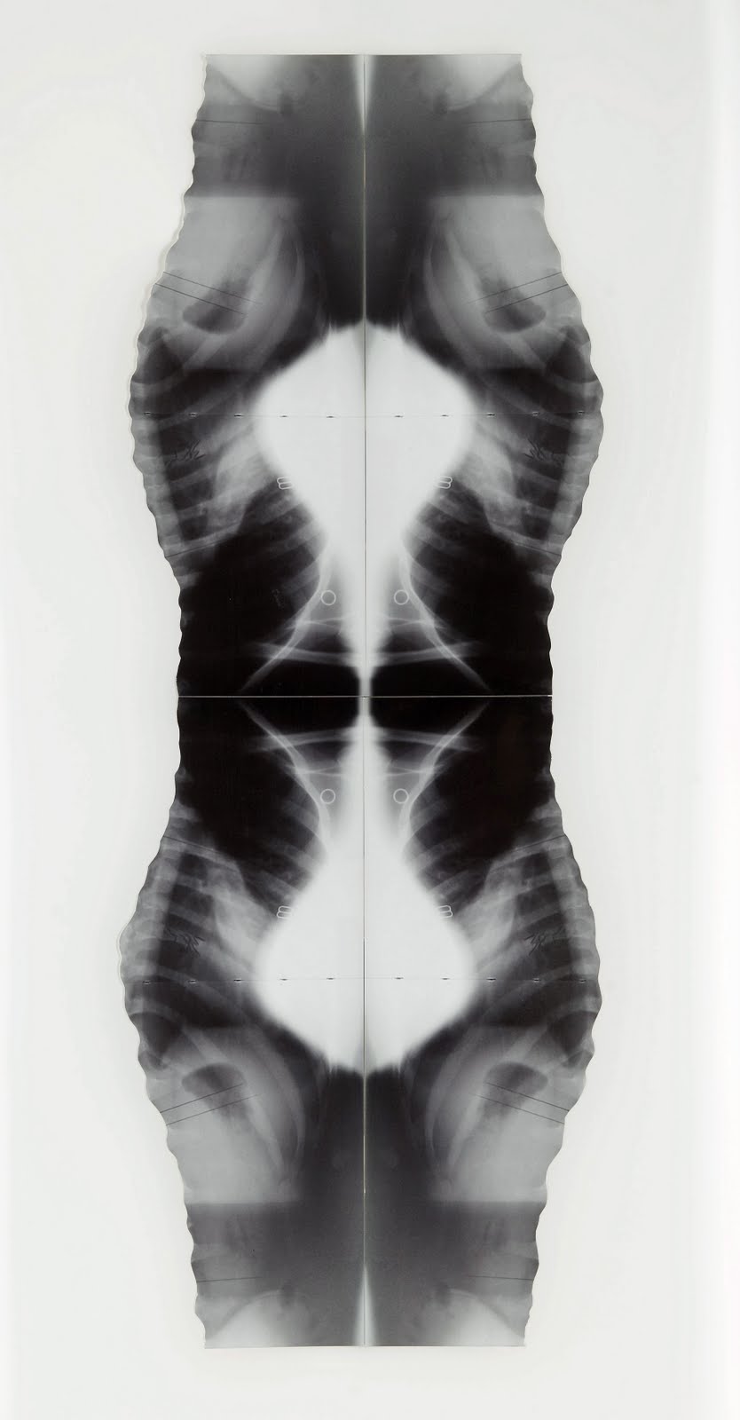 Jason Eden: X - Rays