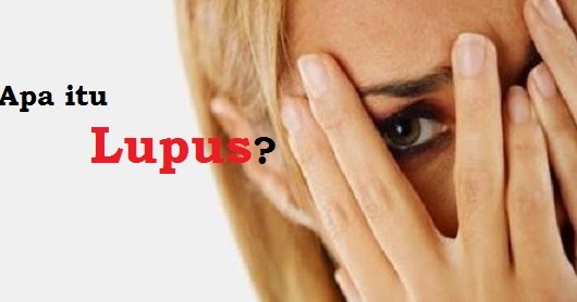 Apa itu Lupus? - Tips Kesehatan