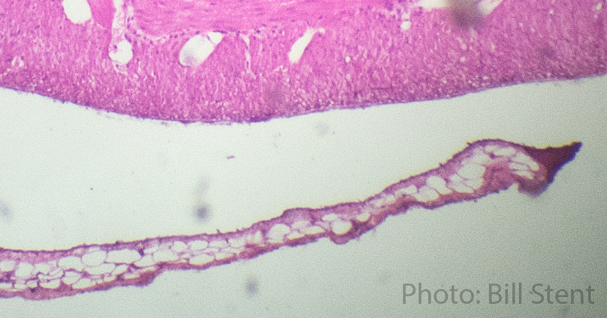How to put a DSLR camera on a microscope