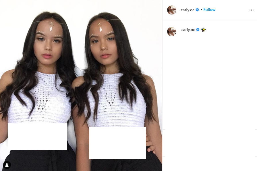 Video Connell Twins VIRAL, Begini 5 Gaya The Connell Twins