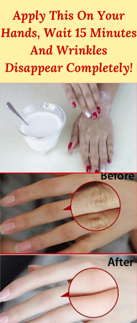 Home Remedies To Eliminate Wrinkles In The Hands | Wellness Today