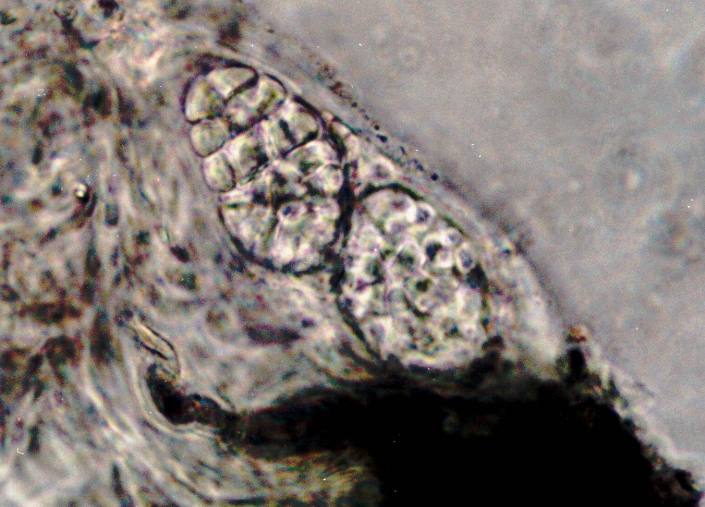 The Mycelium Connection: Fungal Word Friday: Muriform