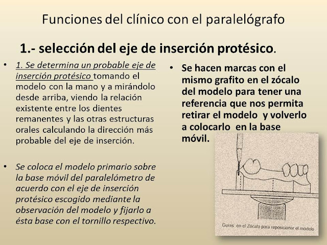 REHABILITACIÓN II: El paralelógrafo y su uso para la selección del ...