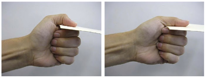 White Tower・White Jungle: [外科筆記] 整型外科・尺神經損傷評估・Assessment of Ulnar ...