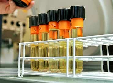 Pruebas de laboratorio: EGO (análisis de resultados)