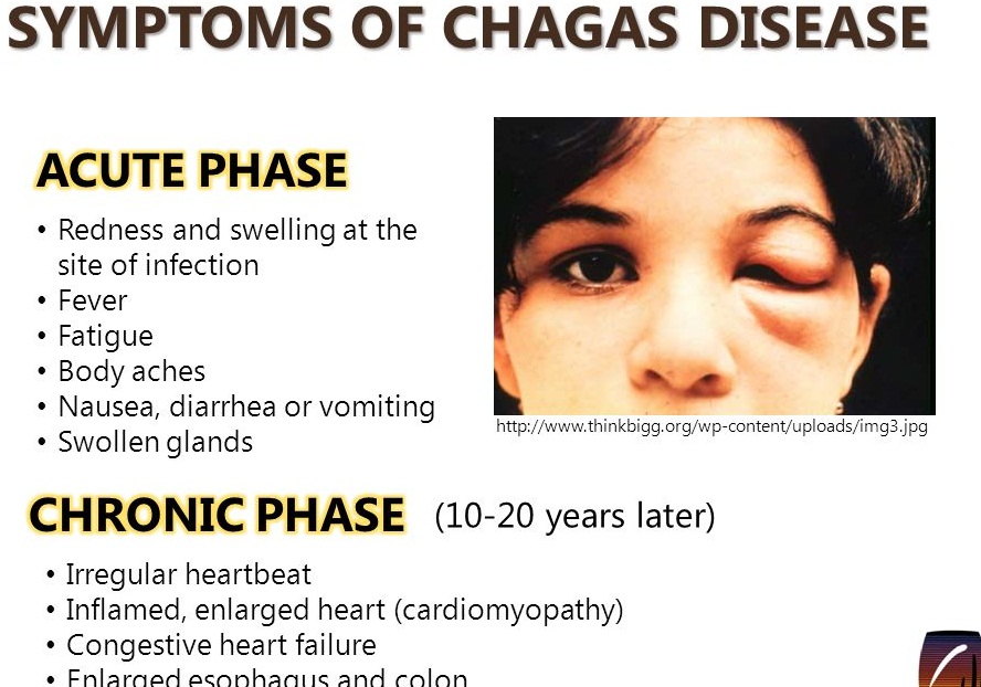 Chagas Disease/What is Chagas Disease?/Chagas illness transmitted?/What ...