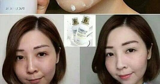 Noor Beauty: MUKA TEGANG & MOIST TANPA SUNTIKAN BOTOX DENGAN CINDELTOX