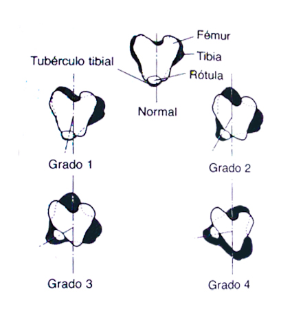 ARTROVET: Luxación de rótula en perro