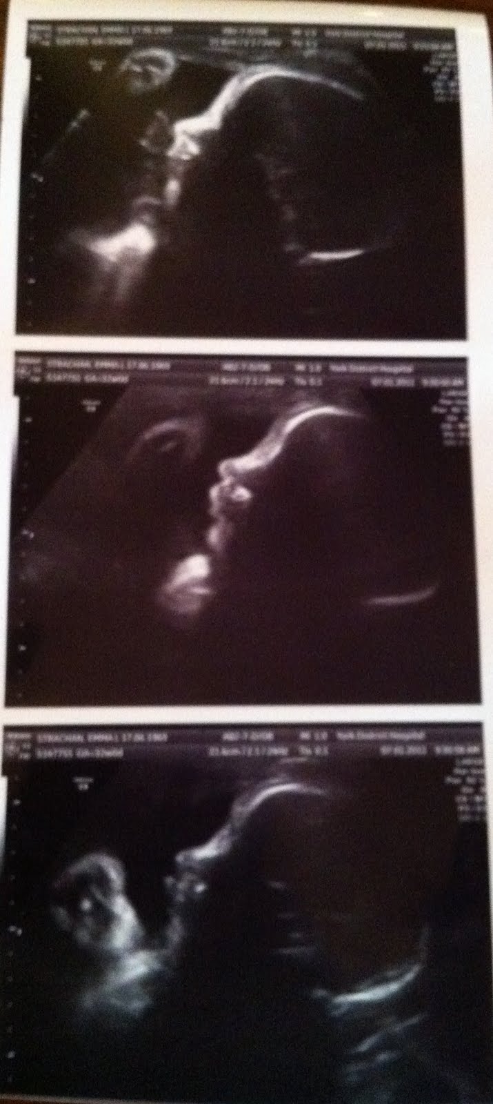 The Baby Making Files: 32 Weeks Scan.