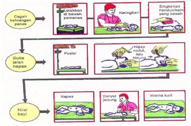 RESUSITASI PADA BAYI DAN RESUSITASI JANTUNG PARU