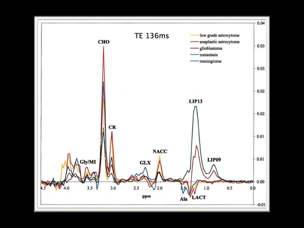 MRI BLOG: Proton MRS Spectra for Selected Brain Pathologies