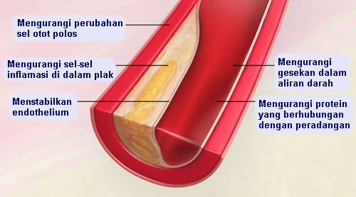 Statin, Obat Kolesterol Tinggi, Cara Kerja dan Efek Sampingnya